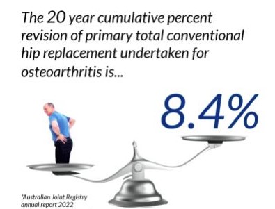 No One is Too Fat For Total Hip Replacement Surgery - Best Practice ...