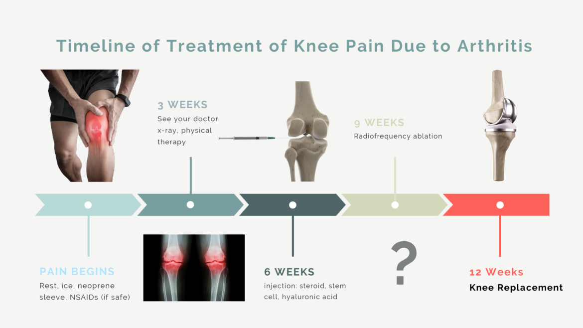 Radiofrequency ablation provides hope for knee pain due to arthritis ...